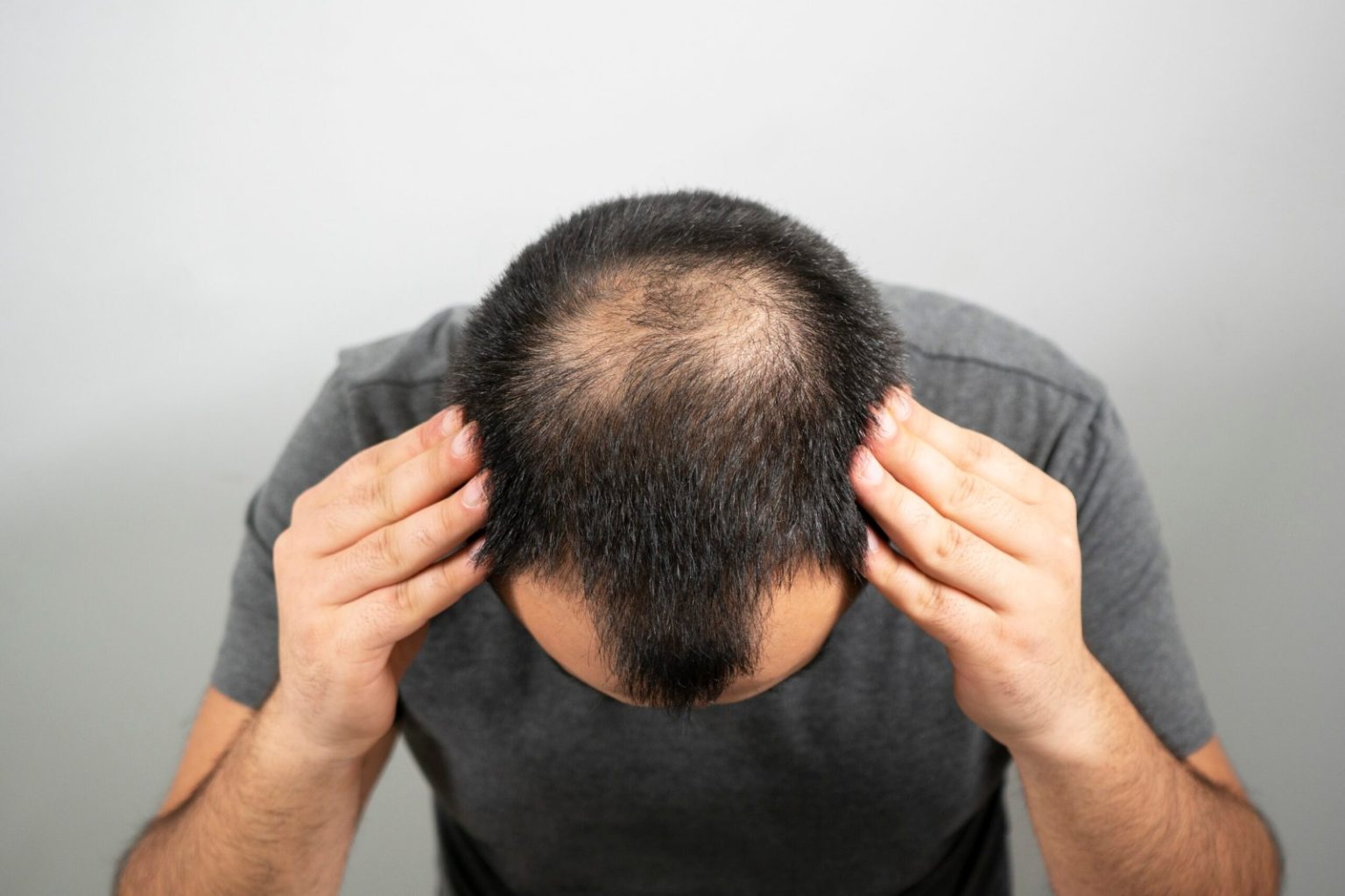 Can Wearing a Ponytail Lead to Hair Loss? - The Action Elite